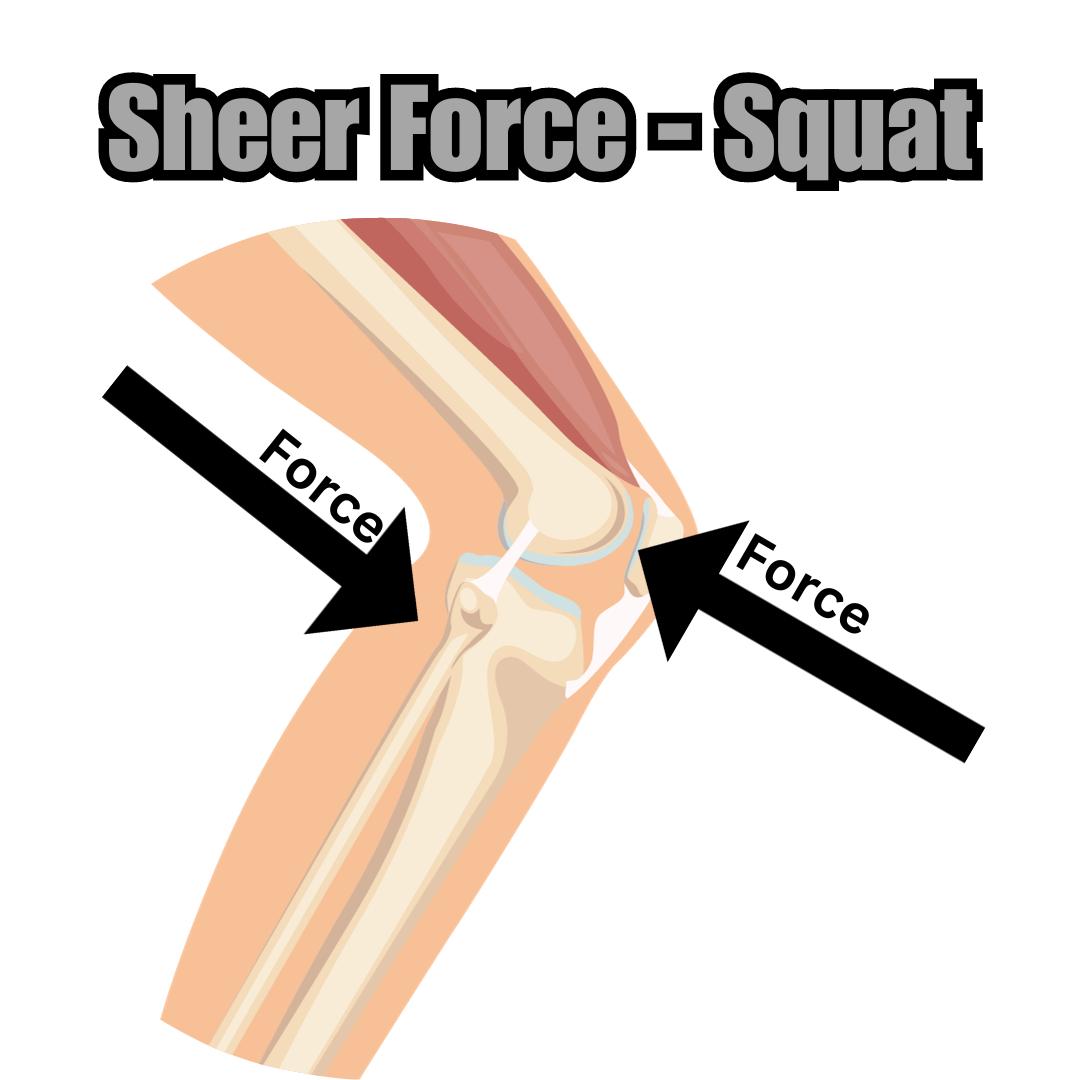 Stop With the Heel-Elevated Squats: It’s Not Your Ankles — theLDSP