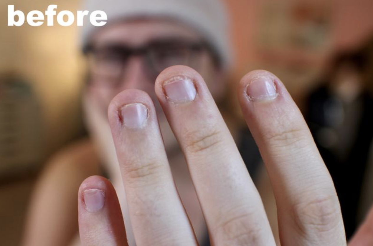 Breaking My Nail Biting Habit — NAIL CAREER EDUCATION