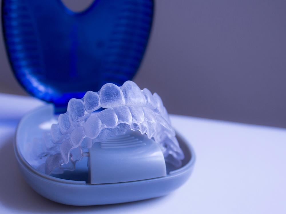 Invisalign — Luxe Dental Dallas