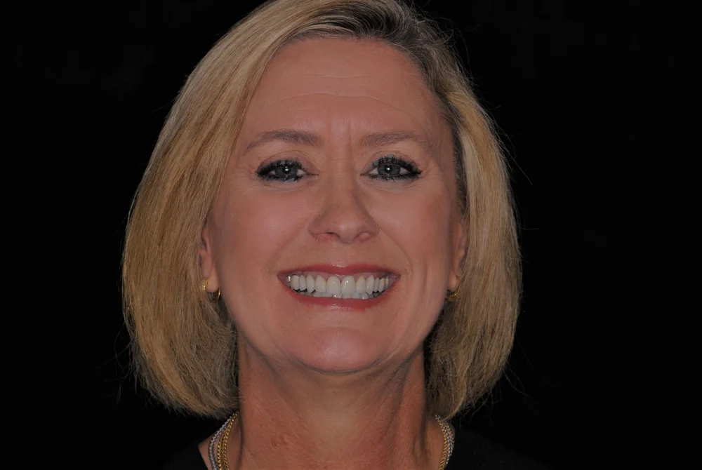Gallery 1 — Jeff Bauer, DDS, PLLC