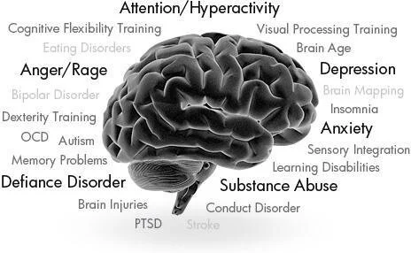 Acuity Brain Center — MaxHealth Family, Internal & Sports Medicine