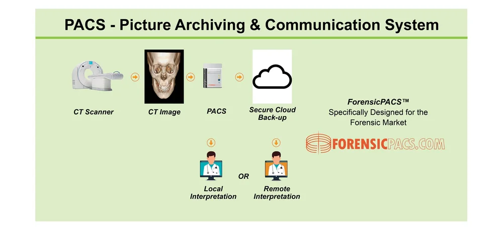 Post-Mortem CT (PMCT) — ADS