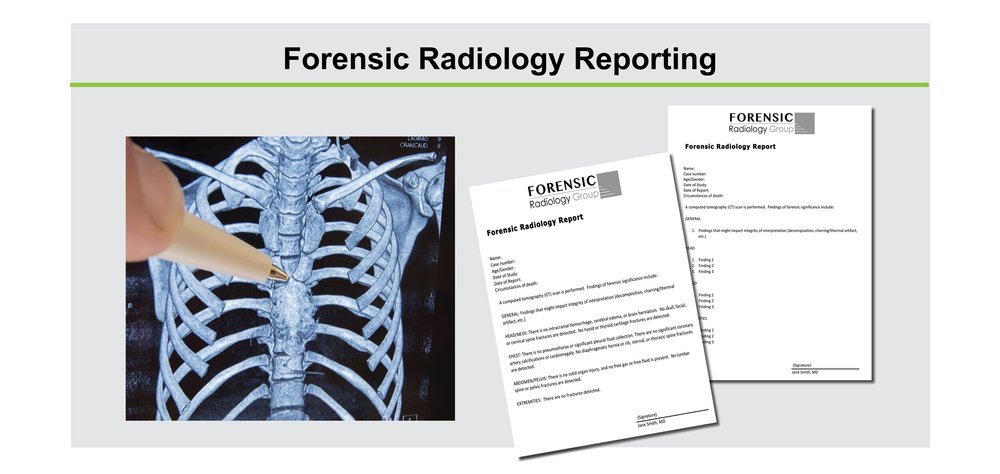 Post-Mortem CT (PMCT) — ADS
