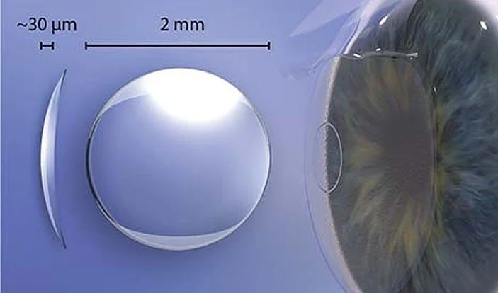 Jimmy Hu, MD | Ophthalmologist (Eye Doctor) | Cataract, Cornea and ...