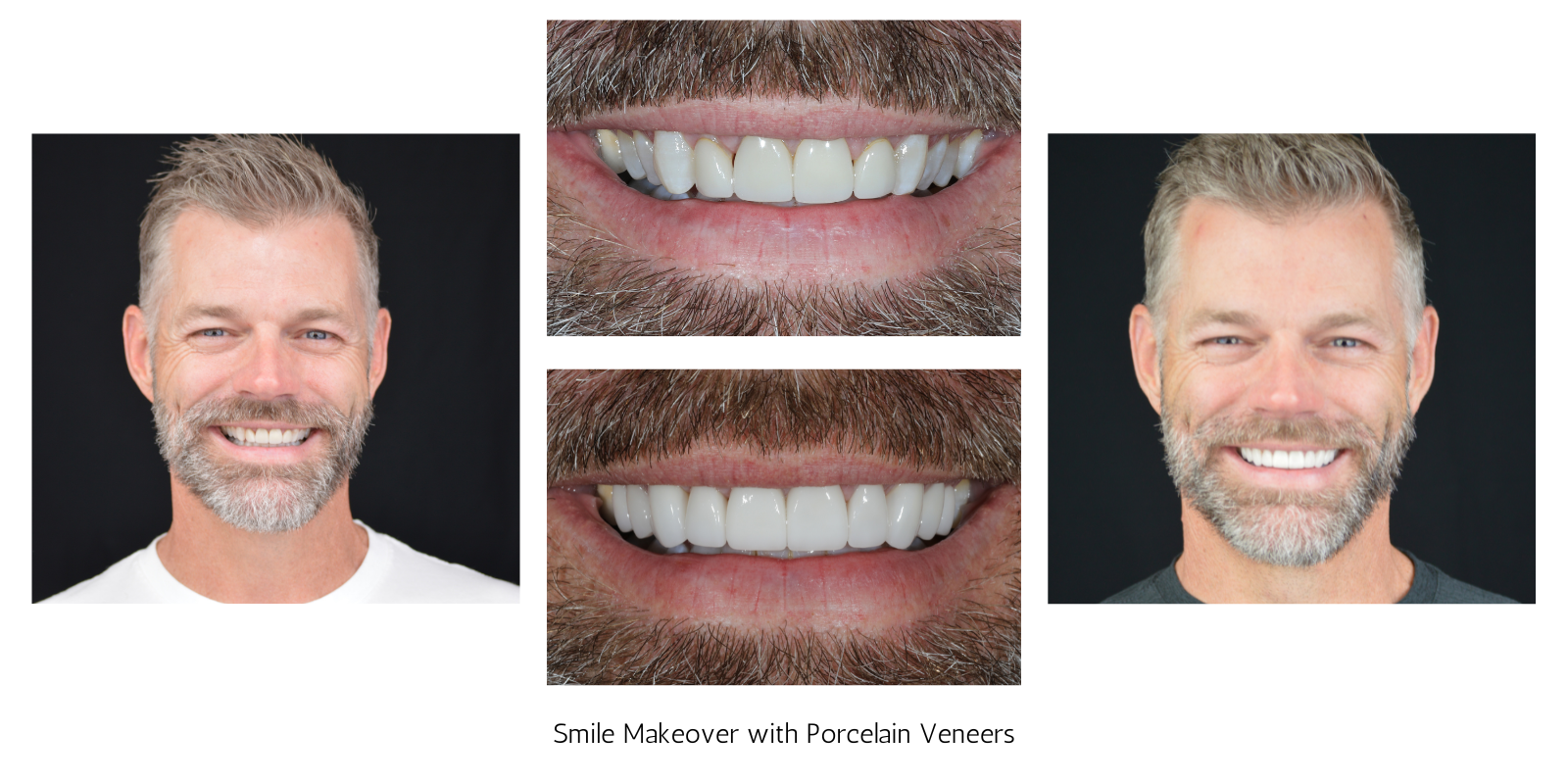 Joyful Smiles Before and After Makeovers | Dr. Joy Brauer