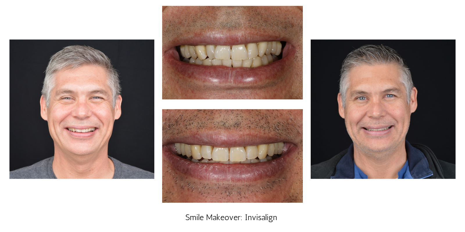 Joyful Smiles Before and After Makeovers | Dr. Joy Brauer