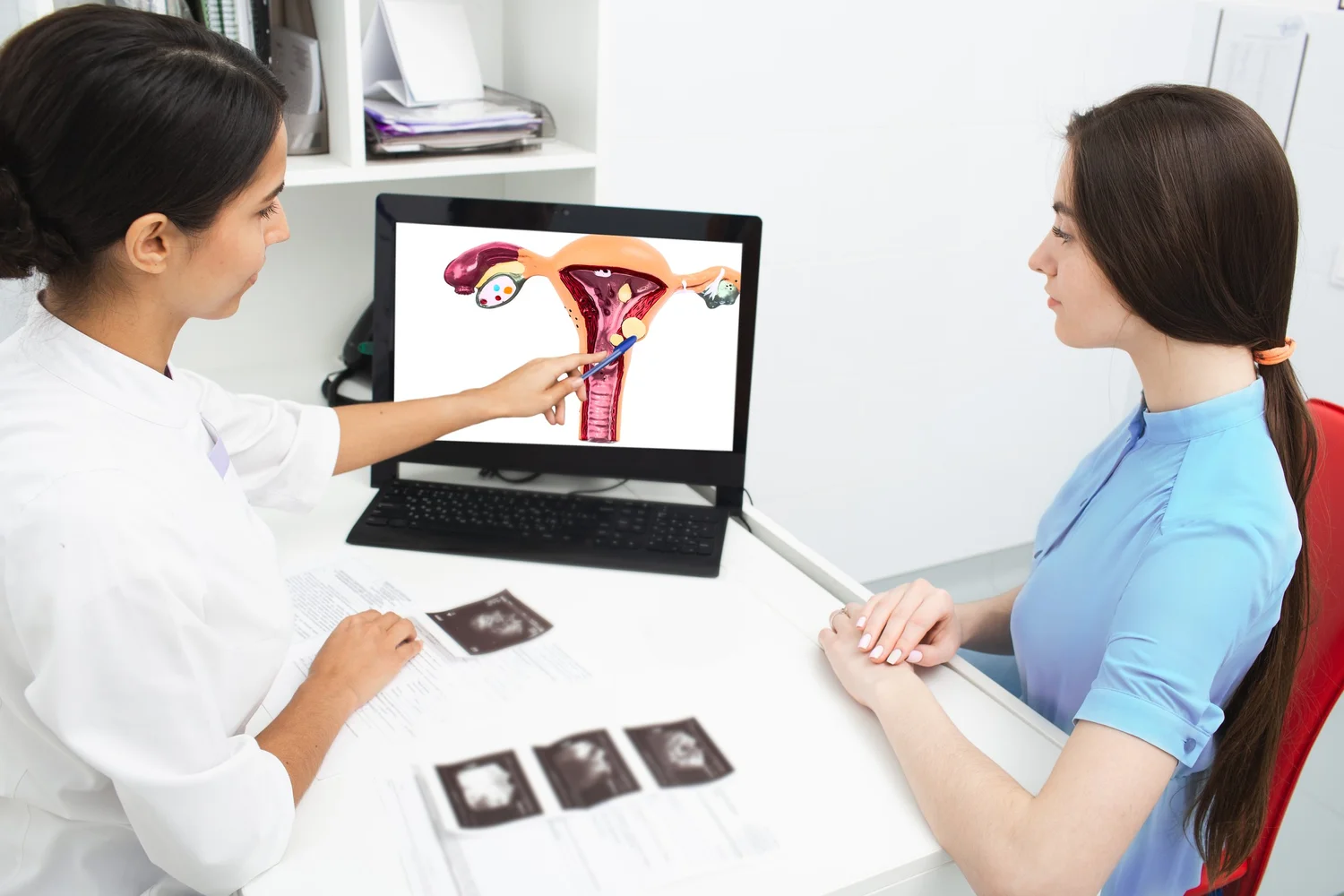 What is an Exophytic Fibroid? - MIMIT Health
