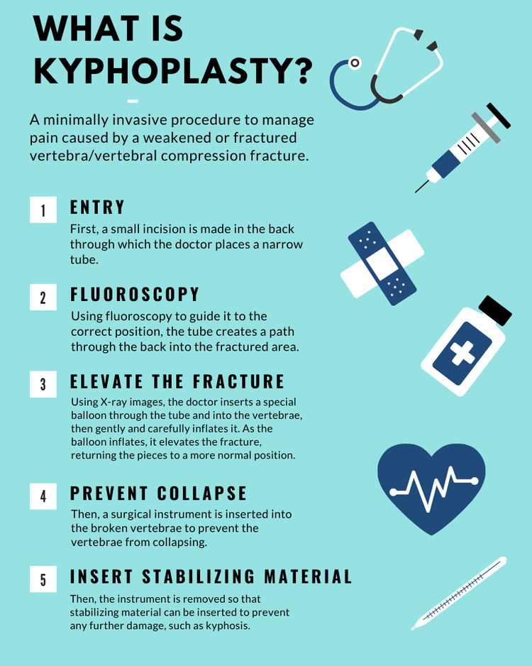 What is Kyphoplasty? - MIMIT Health