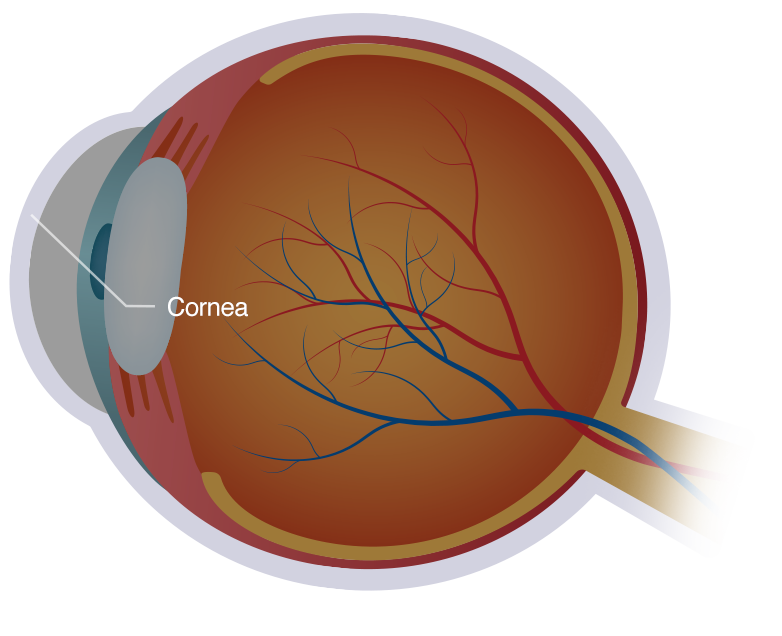 Corneal Conditions — EyeCare 20/20