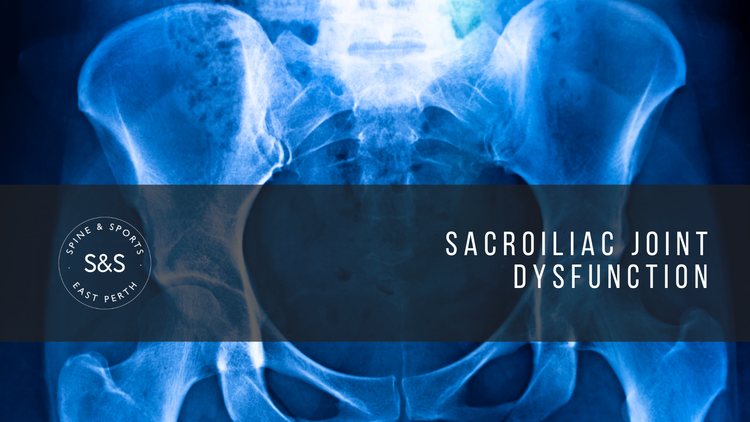 Sacroiliac Joint Dysfunction X Ray