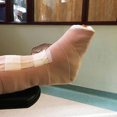 How to Prepare for Foot Surgery — Precision Foot and Ankle Centers