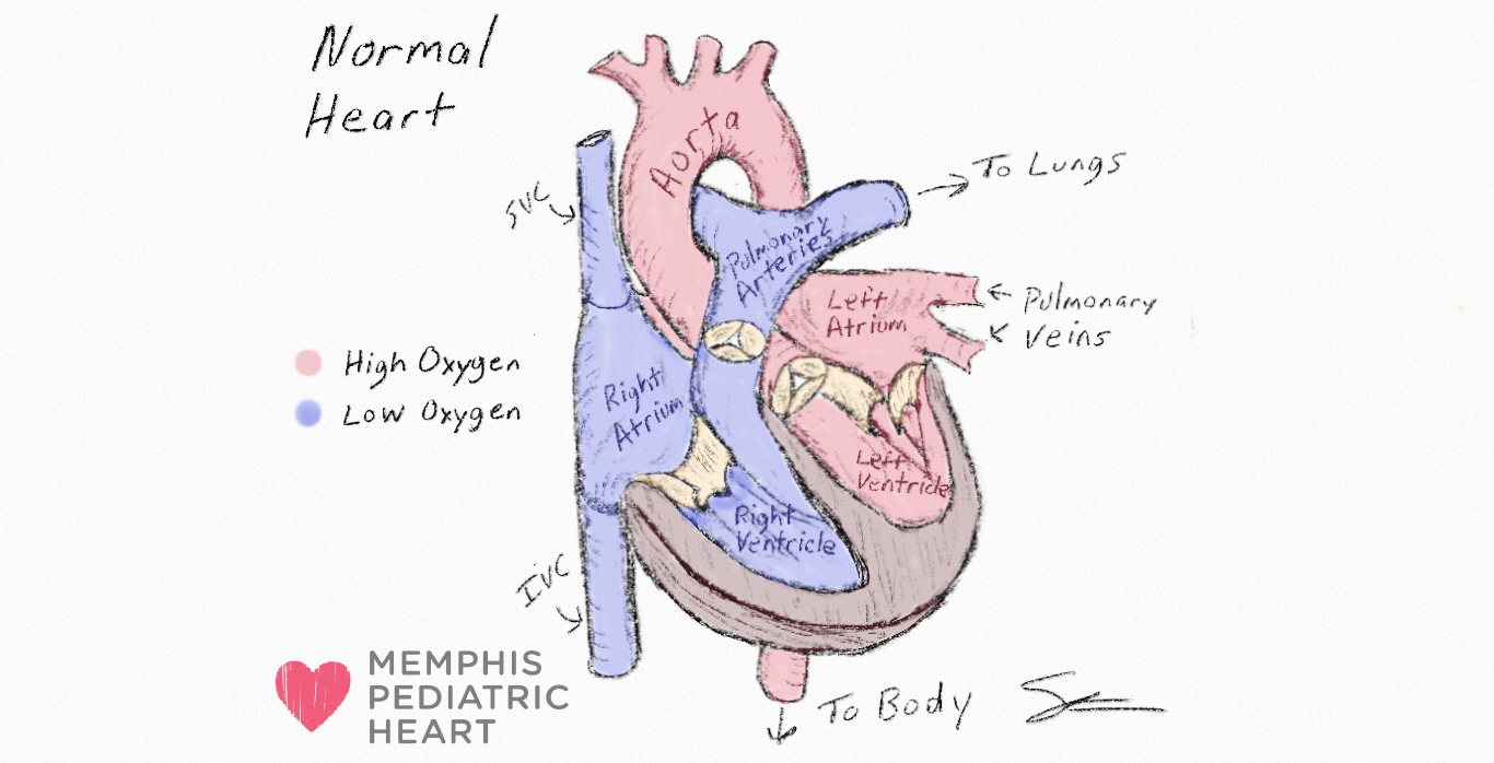 Hypertrophic Cardiomyopathy — Pediatric Cardiologist - Pediatric Heart ...