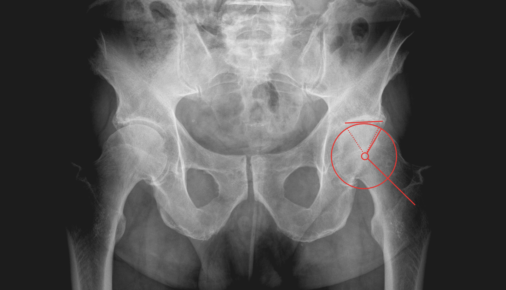 Radiobotics — We do Augmented Radiology