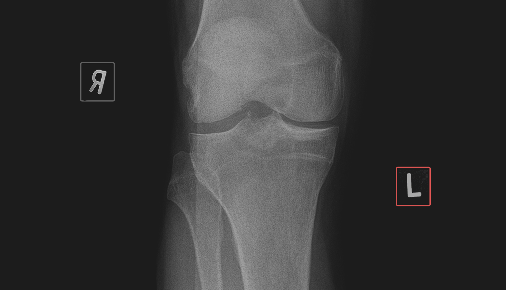 Radiobotics — We do Augmented Radiology