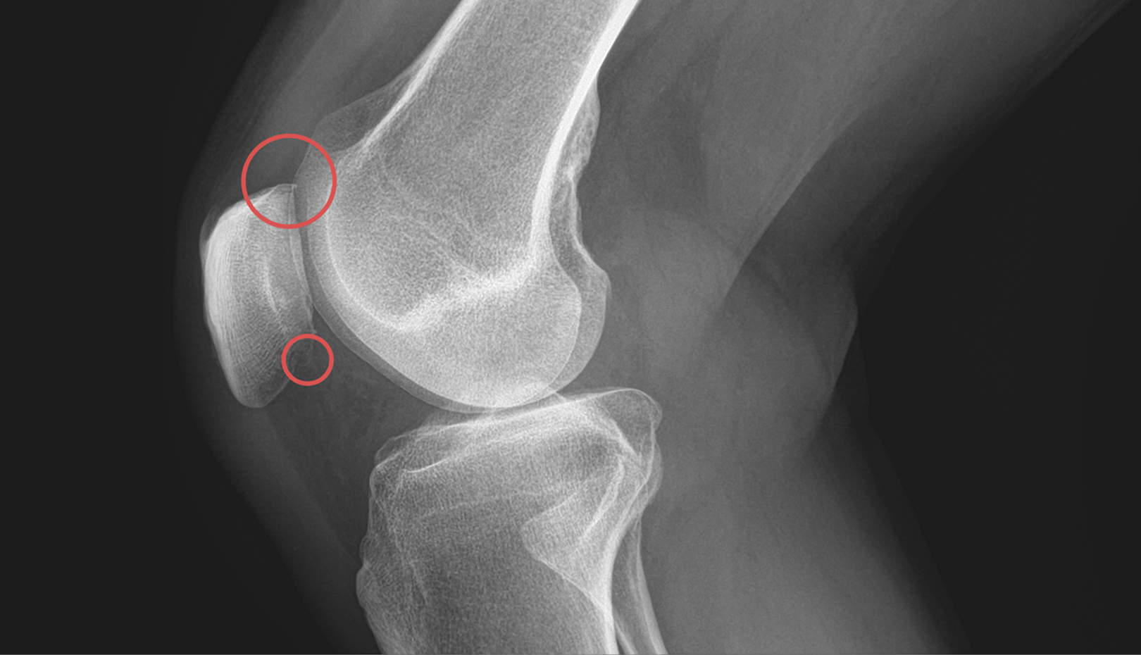 Radiobotics — We do Augmented Radiology