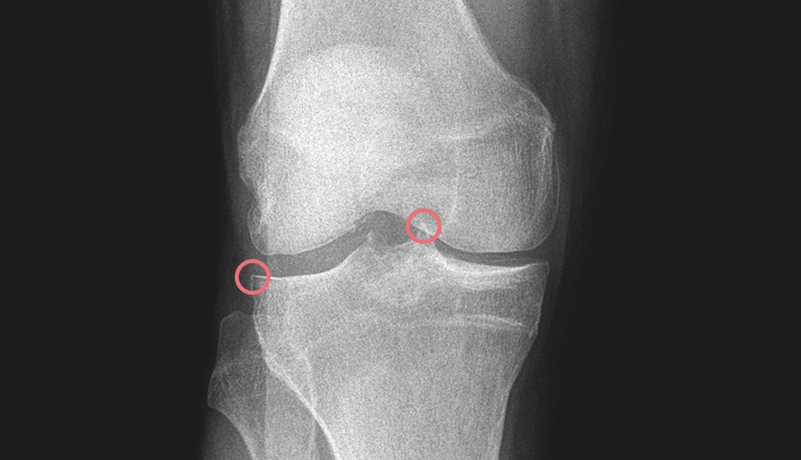 Radiobotics — We do Augmented Radiology