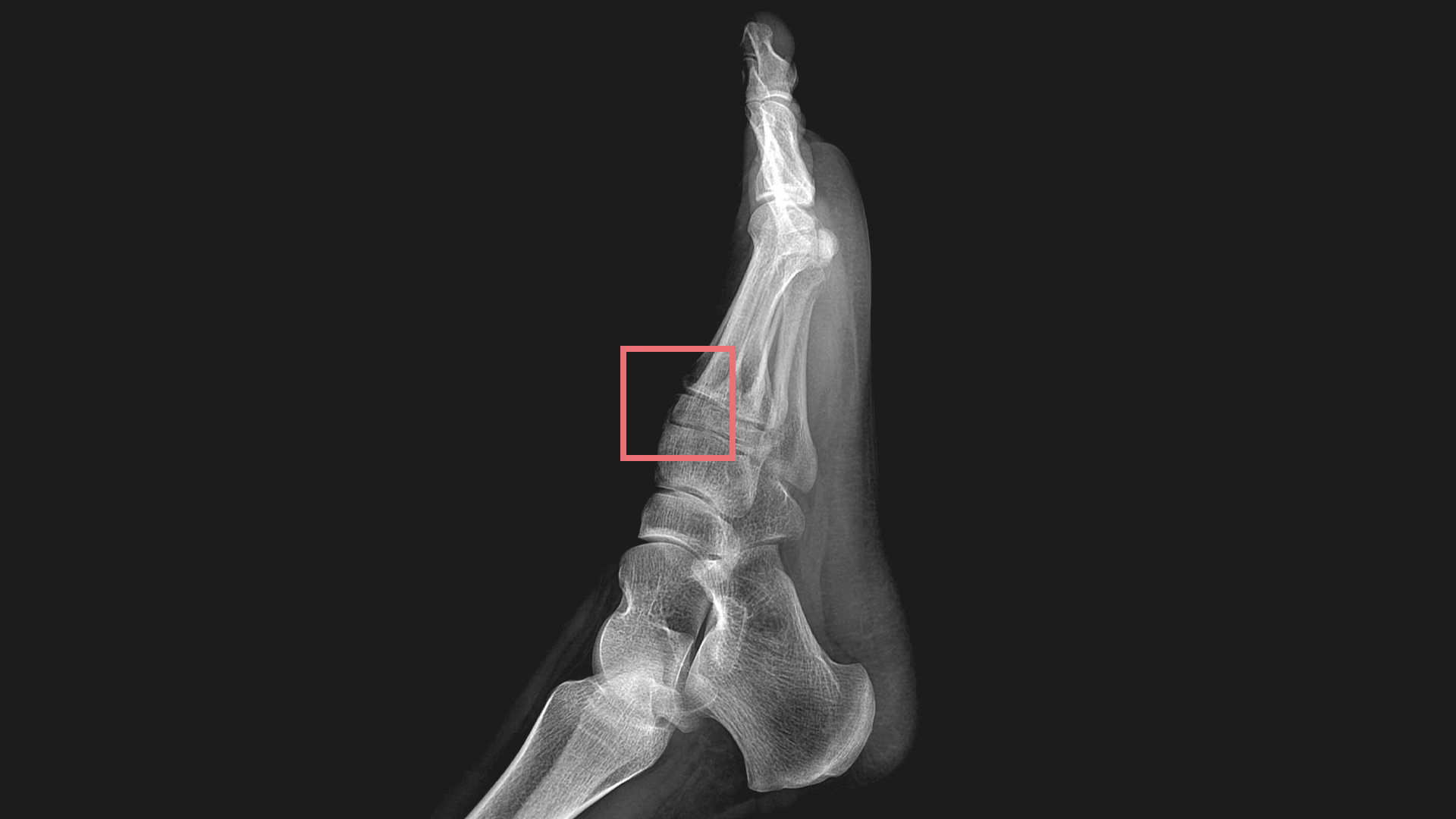 Radiobotics — We do Augmented Radiology