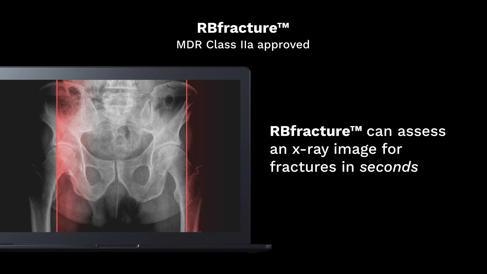 Radiobotics — We do Augmented Radiology