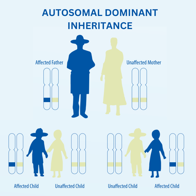 All About Hypertrophic Cardiomyopathy (HCM) — Community Health Clinic