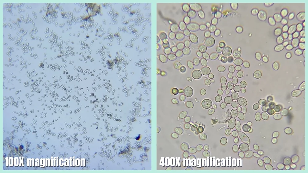 How to tell the difference between Yeast & Bacteria: Visual Comparison — NEAT