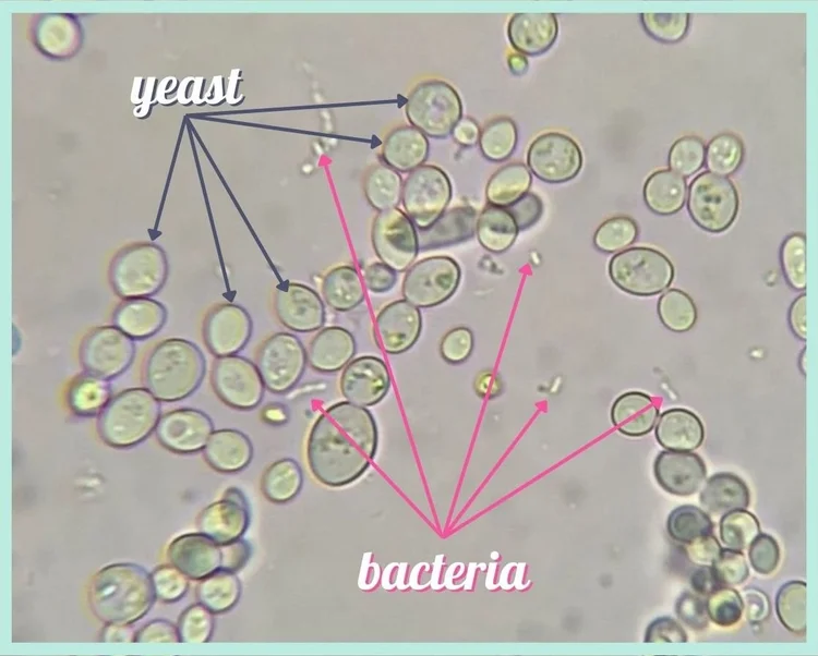How to tell the difference between Yeast & Bacteria: Visual Comparison ...