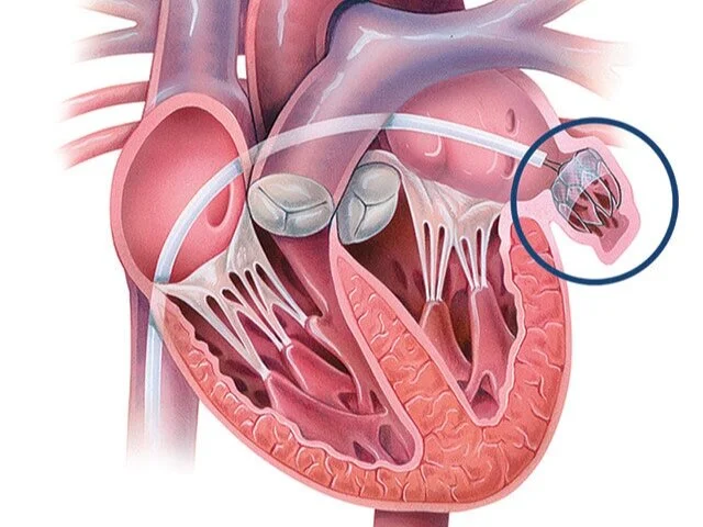 Cardiac Procedures — Coastal Cardiology