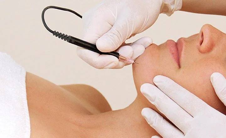 Electrolysis Permanent Hair Removal Mornington Peninsula Regenerate