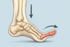 Big Toe Mobility: Enhance Your Movement | San Diego Physical Therapy ...