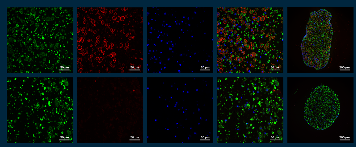 iPSC Skeletal Muscle Myoblasts — Curi Bio