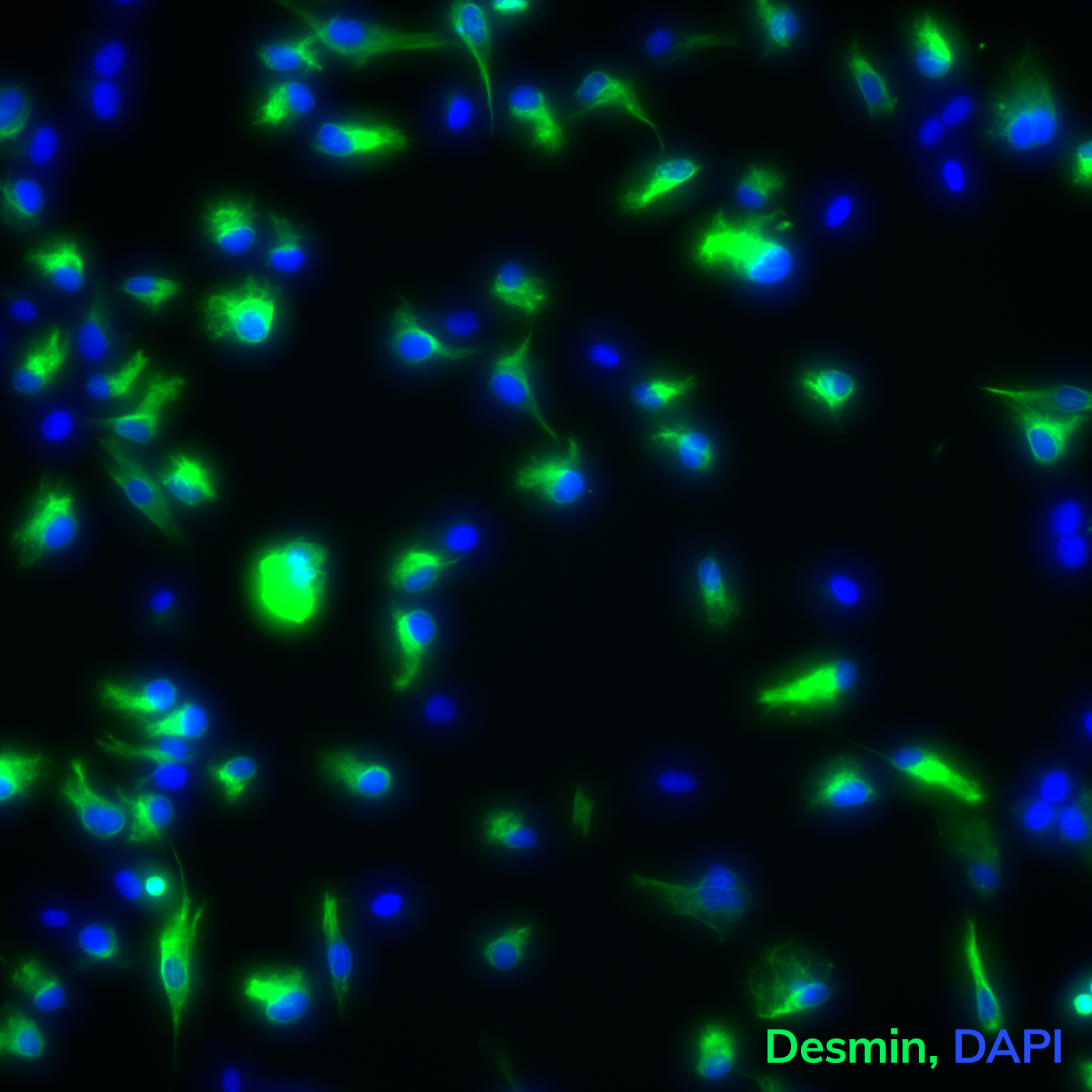 iPSC-derived Skeletal Muscle Myoblasts – High Fidelity DMD Tissue Model ...