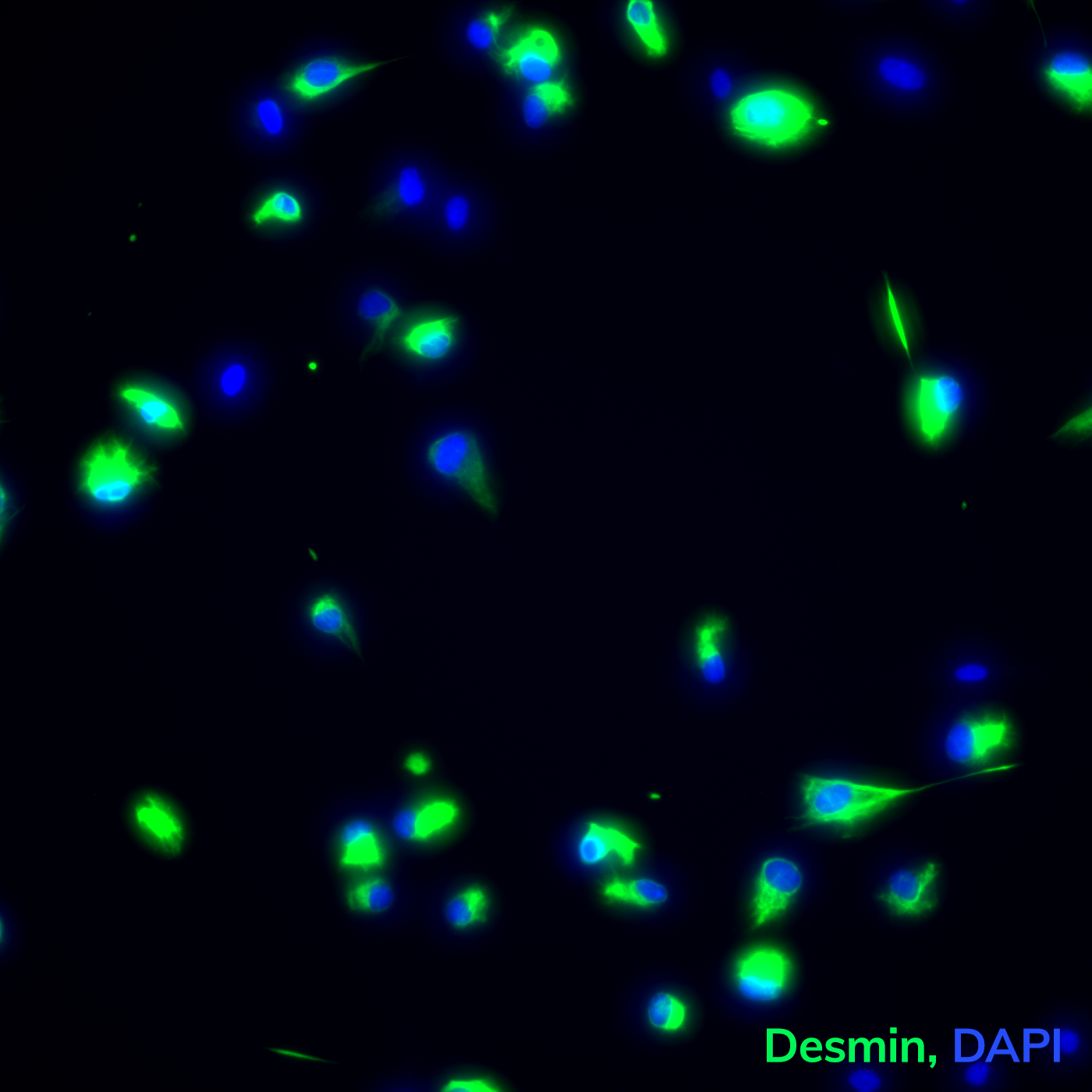 iPSC-derived Skeletal Muscle Myoblasts – High Fidelity DMD Tissue Model ...