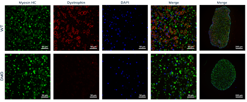 iPSC-derived Skeletal Muscle Myoblasts – High Fidelity DMD Tissue Model ...
