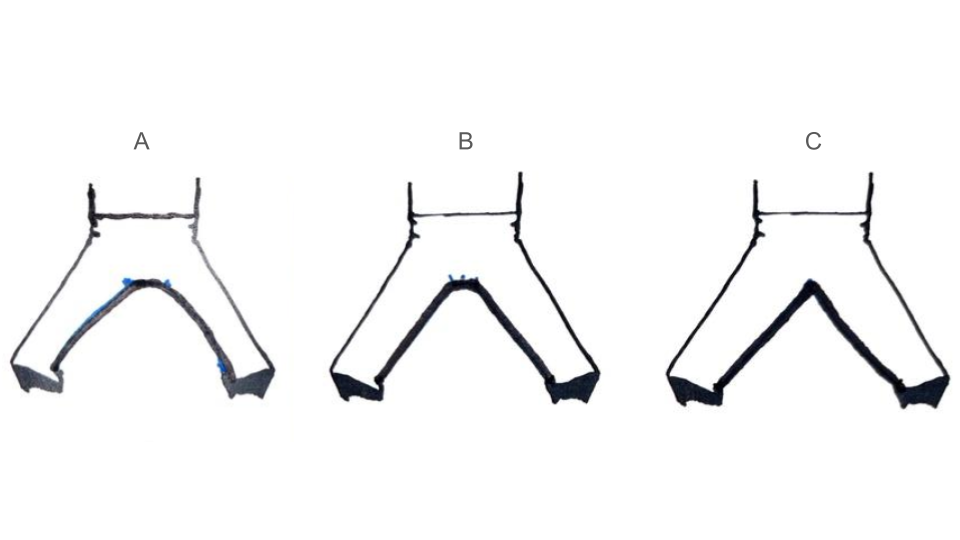 Understanding the twist in an English saddle, and how it relates to ...