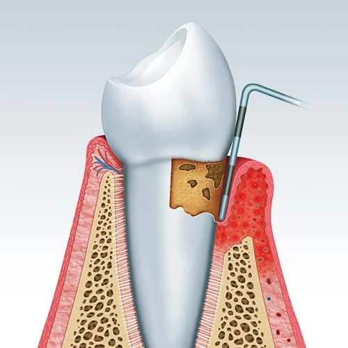 Connecticut Periodontal Specialists