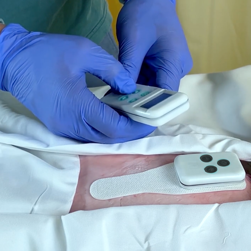 Injectrode — Relief Simplified | Neuronoff