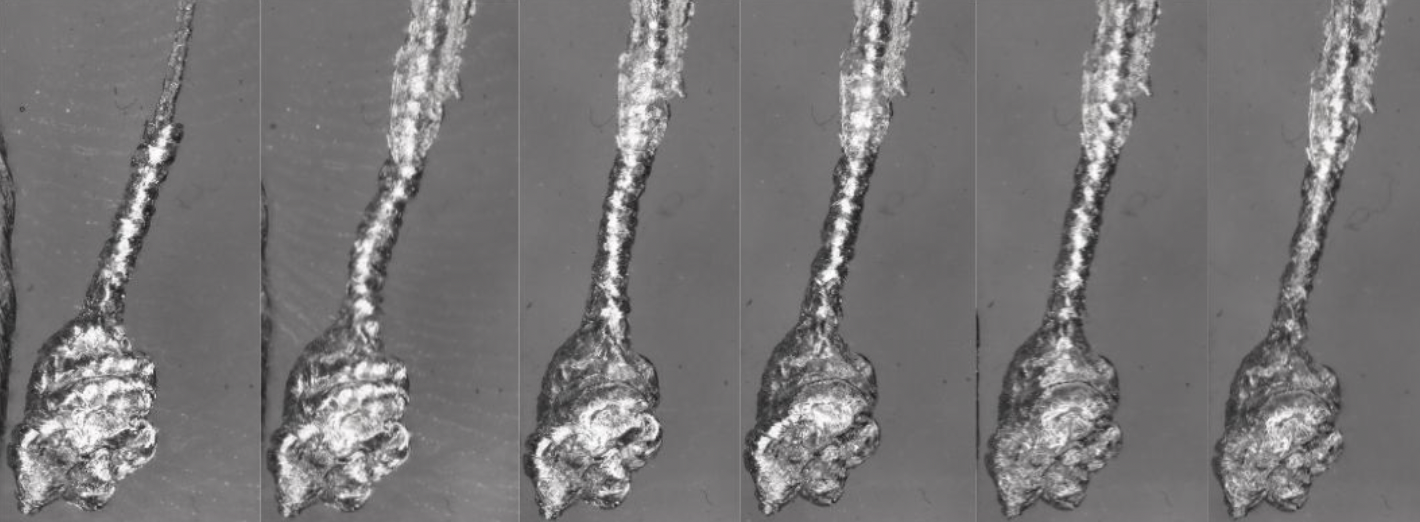 Removal — Relief Simplified | Neuronoff