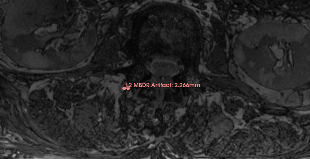 MRI Conditionality — Relief Simplified | Neuronoff