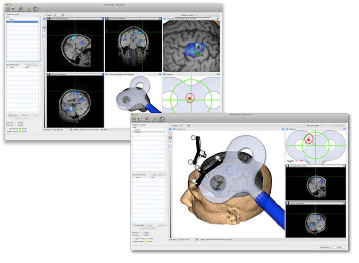 Brain Stimulation Studies of Decision Making Using rTMS — TReAD Lab