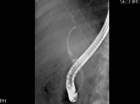 ERCP Commences — Dr Laurence Webber