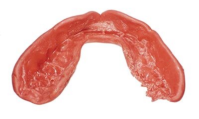 Why Playsafe — PlaySafe Mouthguards