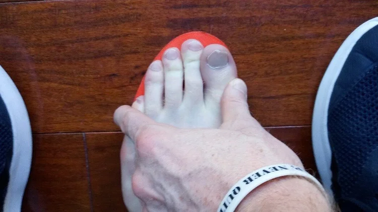 How Shoes Have Degraded the Functional Capacity of Our Feet — Science ...