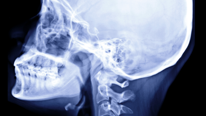 The Surprising Connection Between Your Tongue and Balance: Exploring a ...