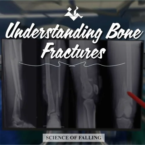 Understanding Bone Fractures — Science of Falling