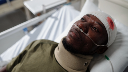 How Falls Cause Traumatic Brain Injuries (TBI): Understanding the Risks ...