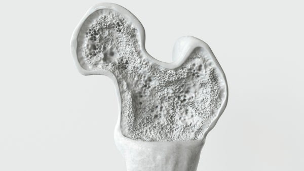 Understanding Bone Fractures — Science of Falling