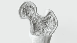 Understanding Bone Fractures — Science of Falling