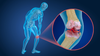 Arthritis Explained: What’s Happening Inside Your Joints — Science of ...