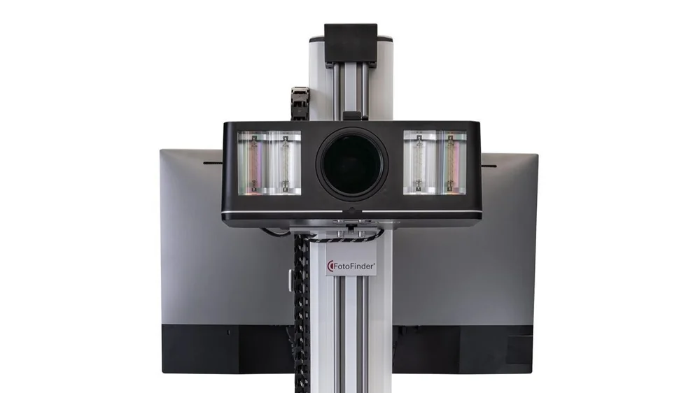 Advanced Mole Mapping in Toronto | Fee $350 | Early Skin Cancer ...