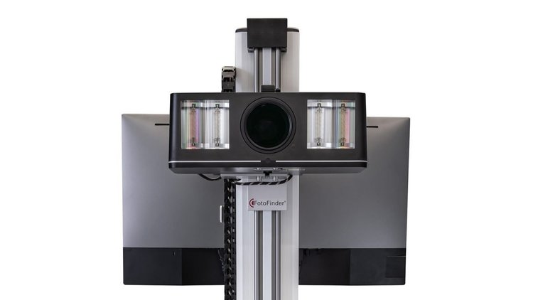 Advanced Mole Mapping in Toronto | Fee $350 | Early Skin Cancer ...