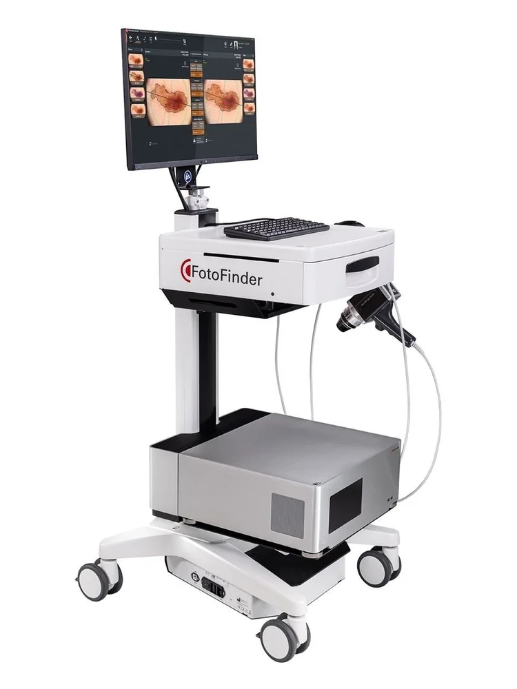 Advanced Mole Mapping in Toronto | Fee $350 | Early Skin Cancer ...